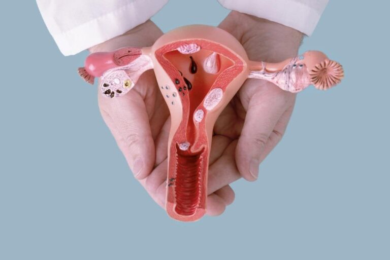 Which Size of Fibroid is Normal? Guide to Uterine Fibroid Sizes ...